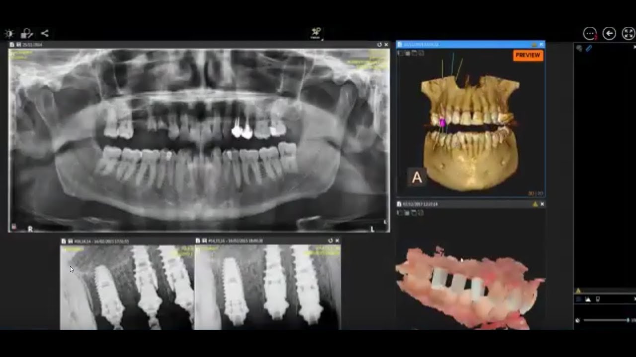 Which Pre-Owned Carestream CBCT System is Right for Me? - Renew Digital ...